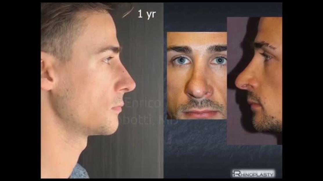 Plastic and Reconstructive Surgery