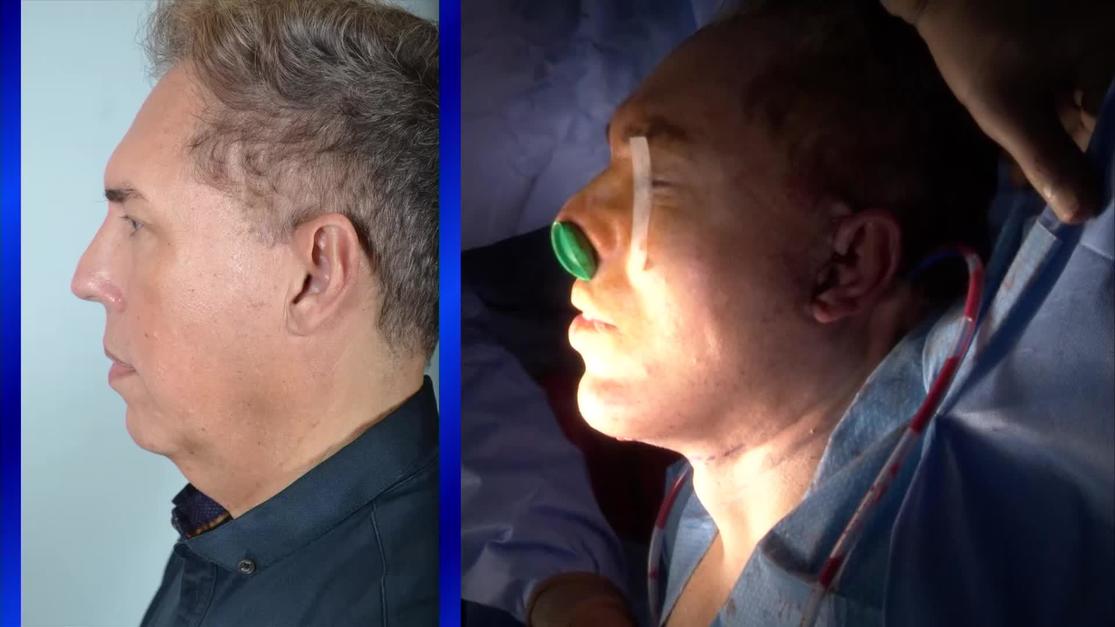 Plastic and Reconstructive Surgery