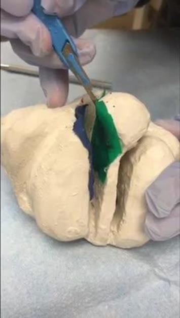 Plastic and Reconstructive Surgery