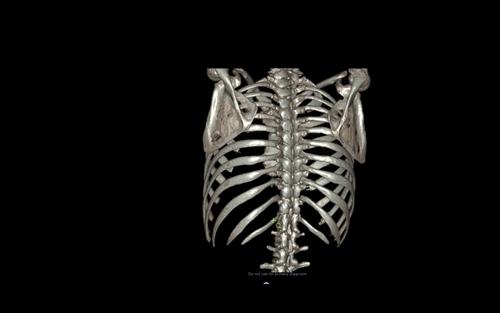 Plastic and Reconstructive Surgery – Global Open