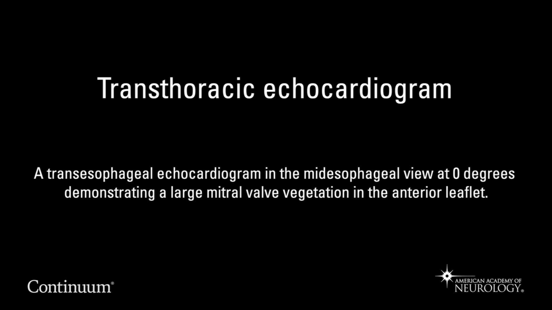 CONTINUUM: Lifelong Learning in Neurology
