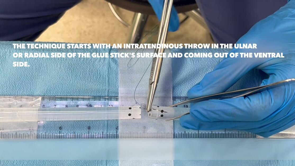 Plastic and Reconstructive Surgery – Global Open