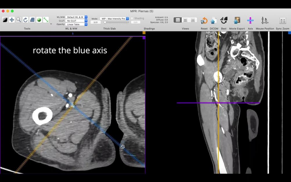 Plastic and Reconstructive Surgery – Global Open