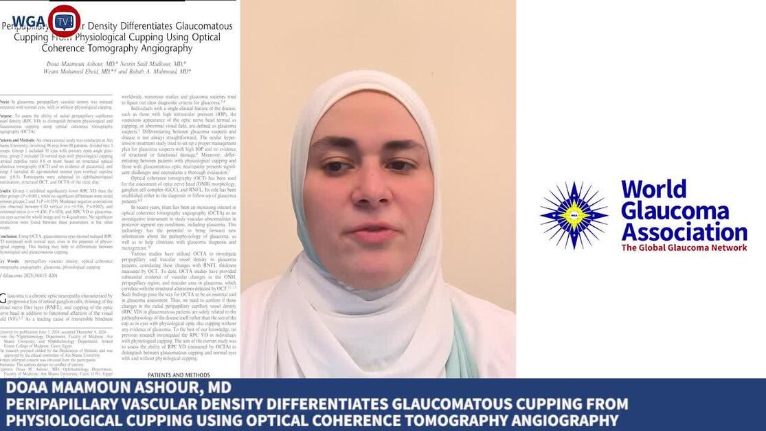 Journal of Glaucoma