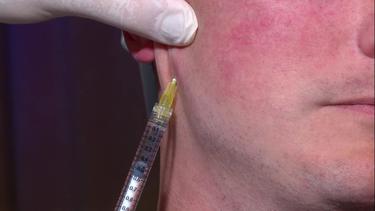 Video Gallery : Plastic and Reconstructive Surgery