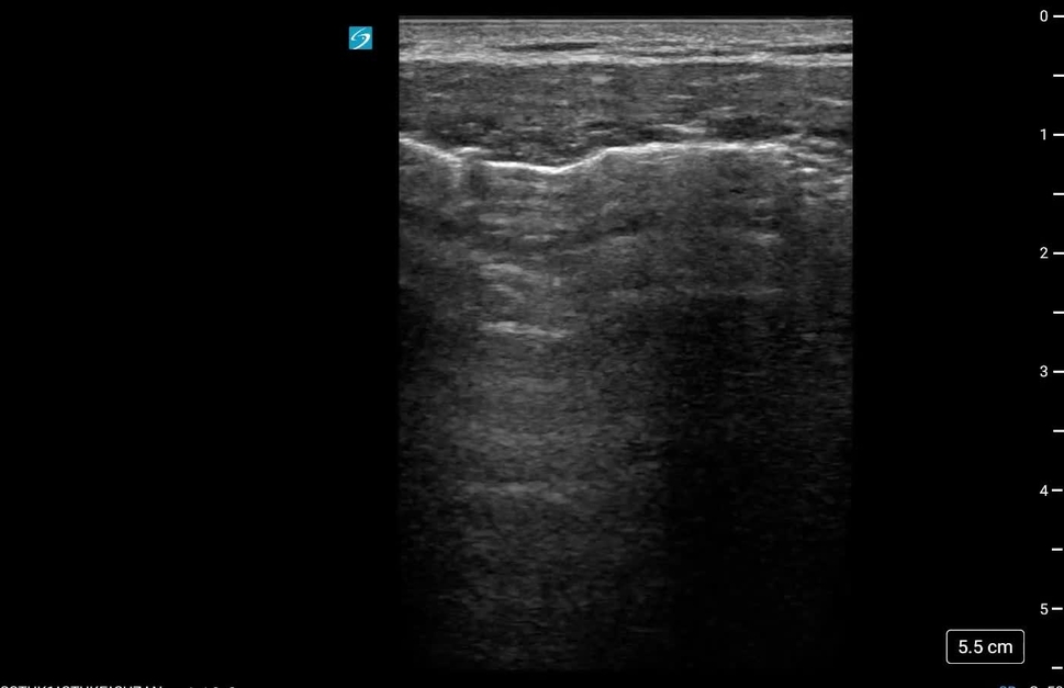 Emergency Medicine News