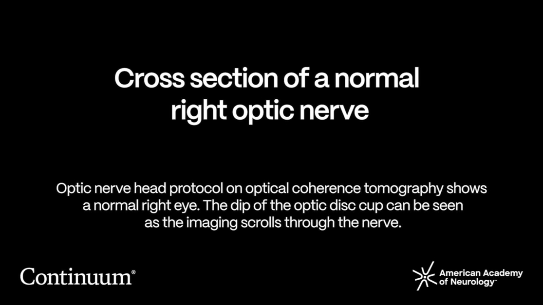 CONTINUUM: Lifelong Learning in Neurology
