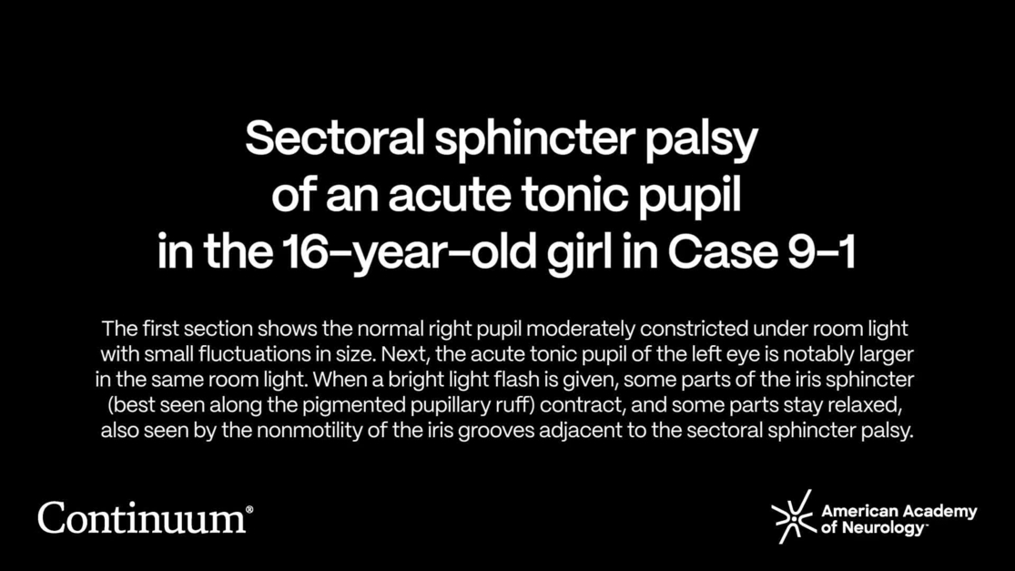 CONTINUUM: Lifelong Learning in Neurology