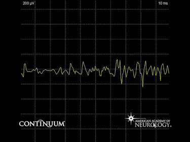 CONTINUUM: Lifelong Learning in Neurology