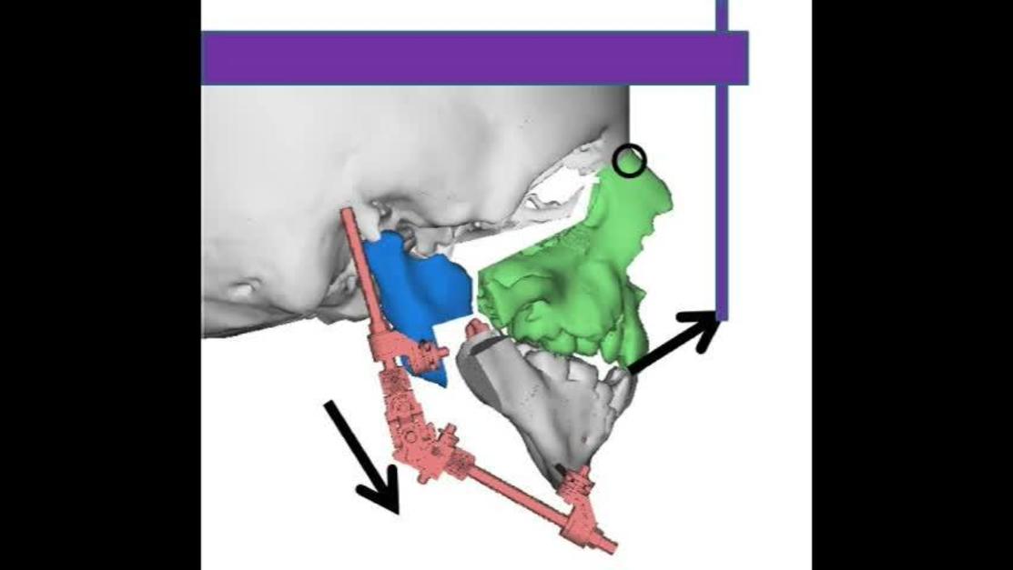 Plastic and Reconstructive Surgery