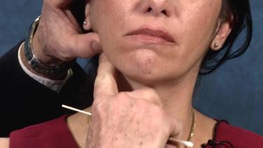 Video Gallery : Plastic and Reconstructive Surgery