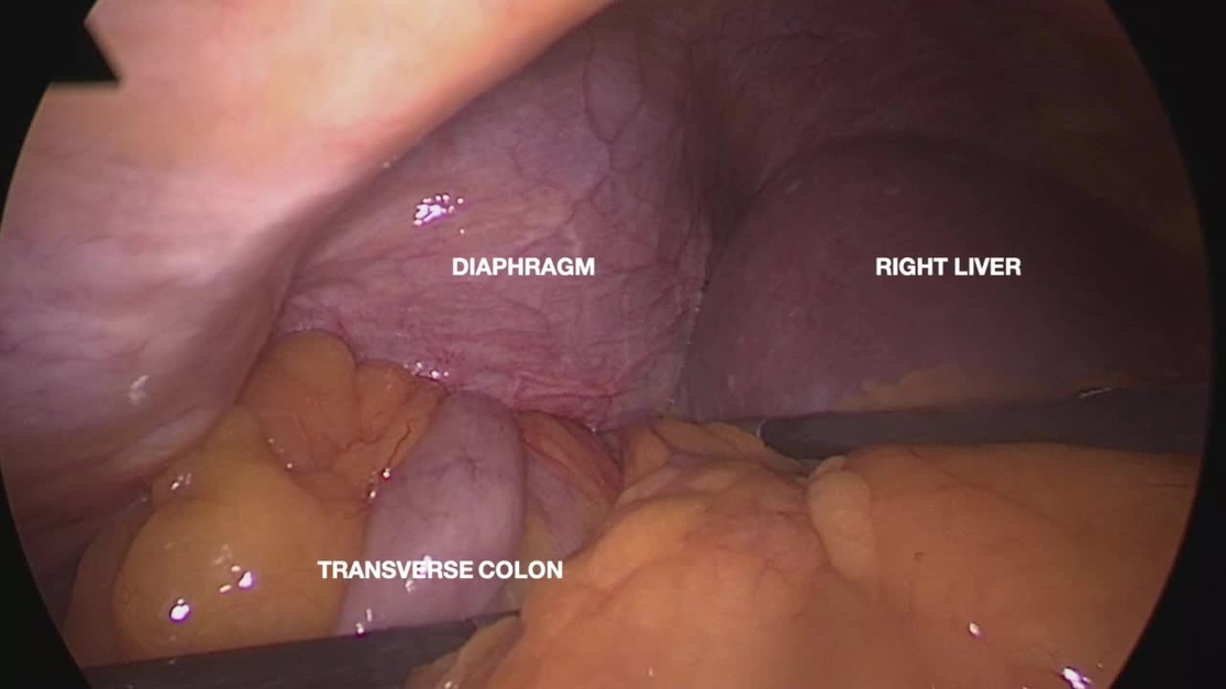 Official journal of the American College of Gastroenterology | ACG