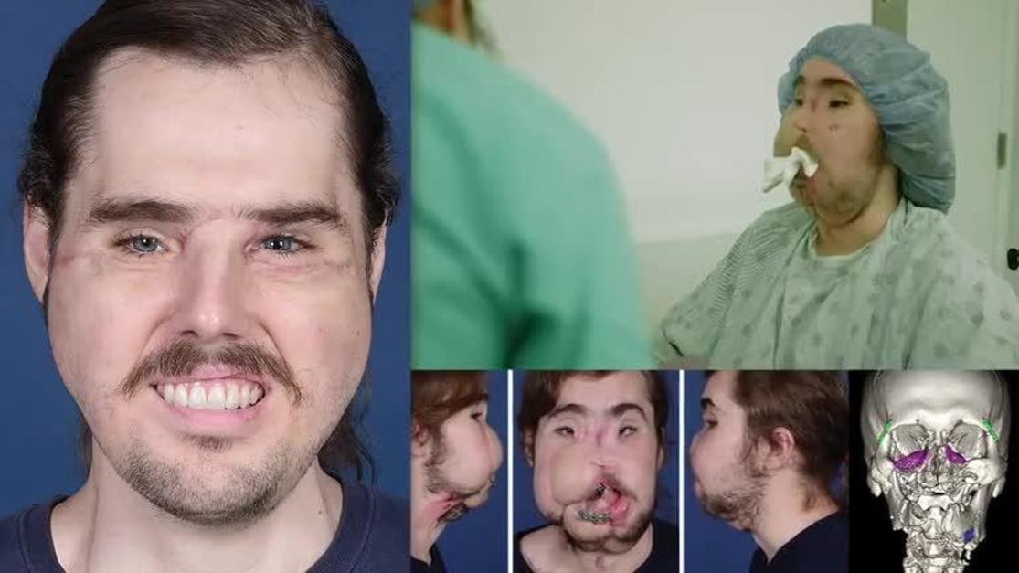 Plastic and Reconstructive Surgery