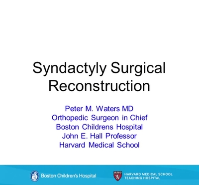 Syndactyly Surgical Reconstruction - POSNAcademy