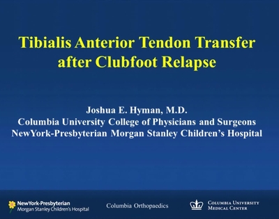 Tibialis Anterior Tendon Transfer After Clubfoot Relapse - POSNAcademy