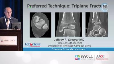 ORIF Triplane Fracture - POSNAcademy