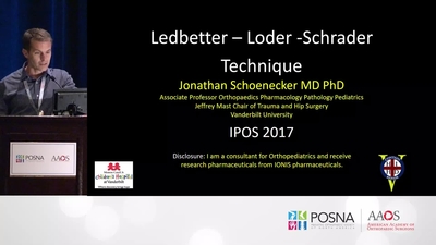 Reduction Technique for Severe SCFE - POSNAcademy