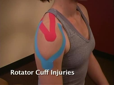 Rotator Cuff Support Taping Technique - UW-Madison Kaltura MediaSpace