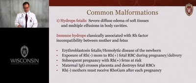 Fetal Development Pathology Clinical Malformations - UW-Madison Kaltura ...