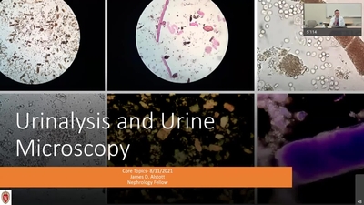 Urinalysis & Urine Microscopy - UW-Madison Kaltura MediaSpace
