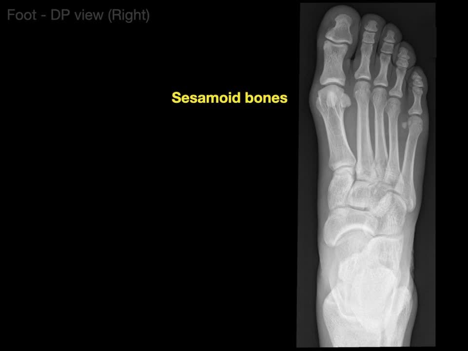 normal left foot xray