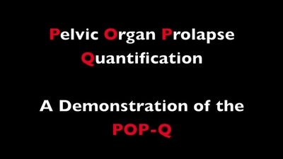 PopQ - The University of Alabama at Birmingham