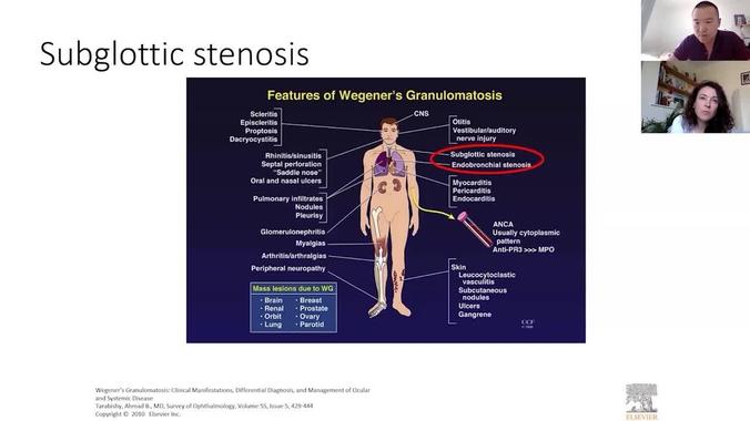 Hoarseness and stridor with Dr Megan Rutter and Mr Henry Zhang | RCP Player