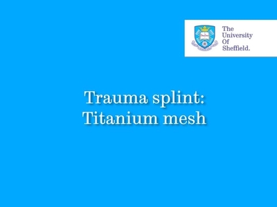 Titanium mesh trauma splint - The University of Sheffield Kaltura ...