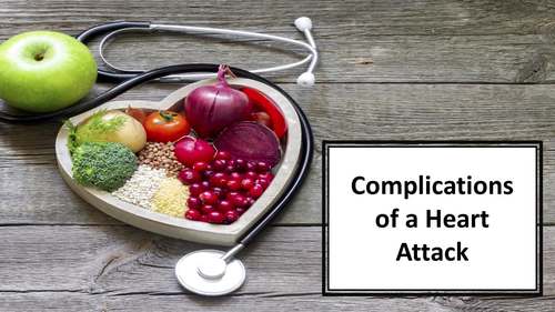 The Complications of a Heart Attack movie mp4 by The Common Core and More