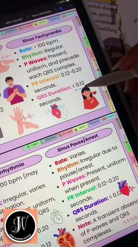 EKG Flashcards With Hyperlinked | Medical Nursing Study | Cardiac Study EKG