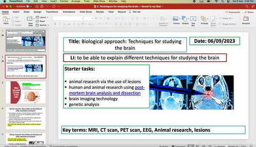 IB Psychology: Techniques and methods to study the brain | TPT