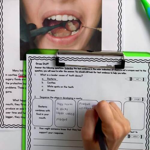 Gross Stuff Lexile Leveled Differentiated Reading Passages - 2nd-5th Grade