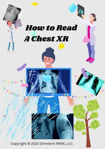 How to Read a Chest X-Ray Just Like a Radiologist Physician! STEM Majors