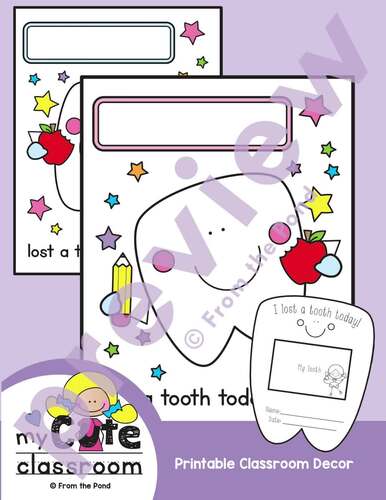Lost Tooth Poster and Take Home Note by From the Pond | TPT