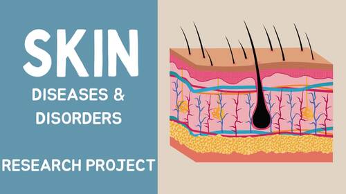 Integumentary System Disorders and Diseases Research Project by Vital ...
