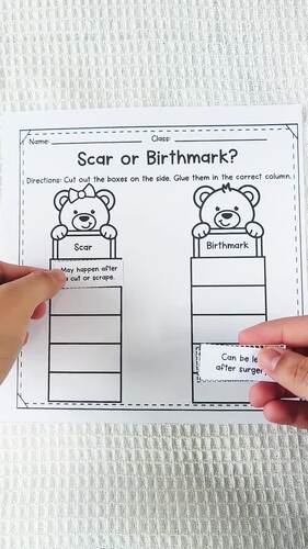 Scar or Birthmark? – Cut and Paste Sorting Activity by Taketing Academy