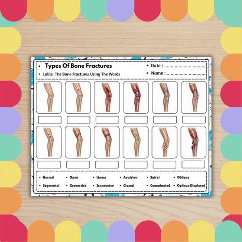 Types of Bone Fractures | Labeling Worksheet, Skeletal System, Anatomy bone
