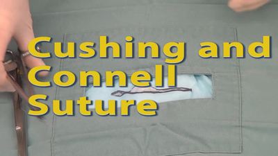 Cushing and Connell Suture - MSU MediaSpace